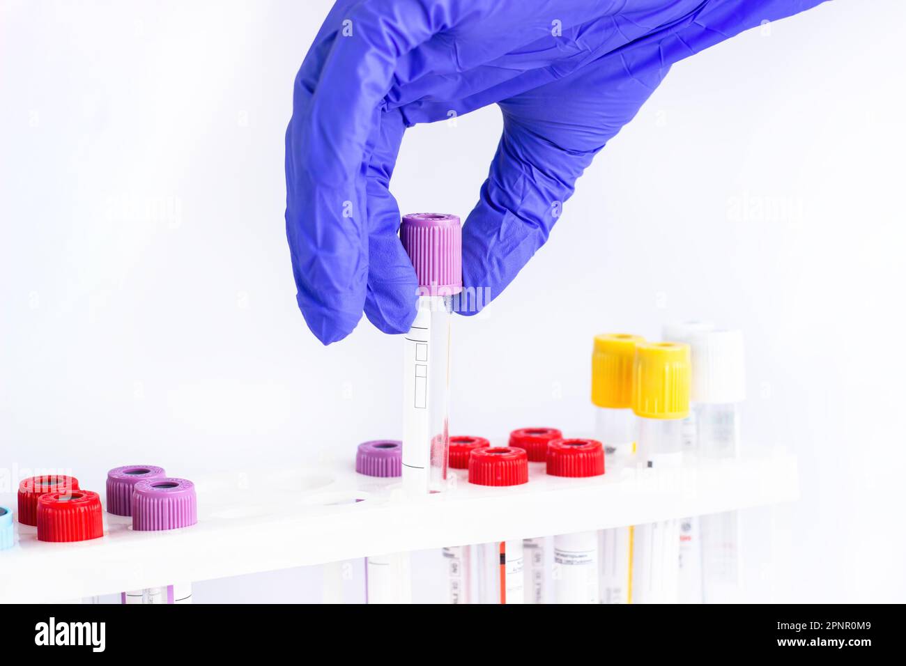 hands of a laboratory assistant with a blood sample and fortitude with ...