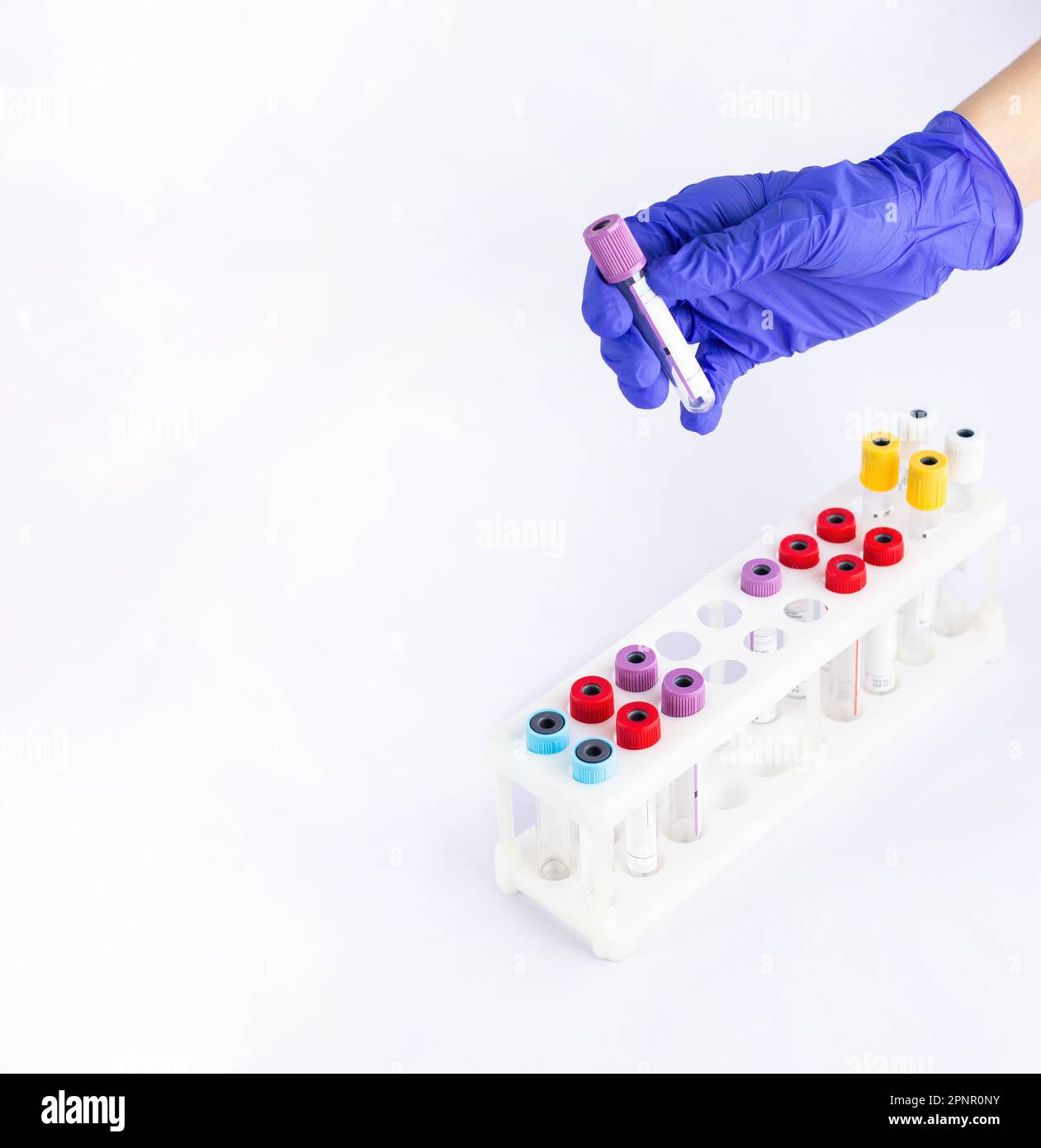 hands of a laboratory assistant with a blood sample and fortitude with ...