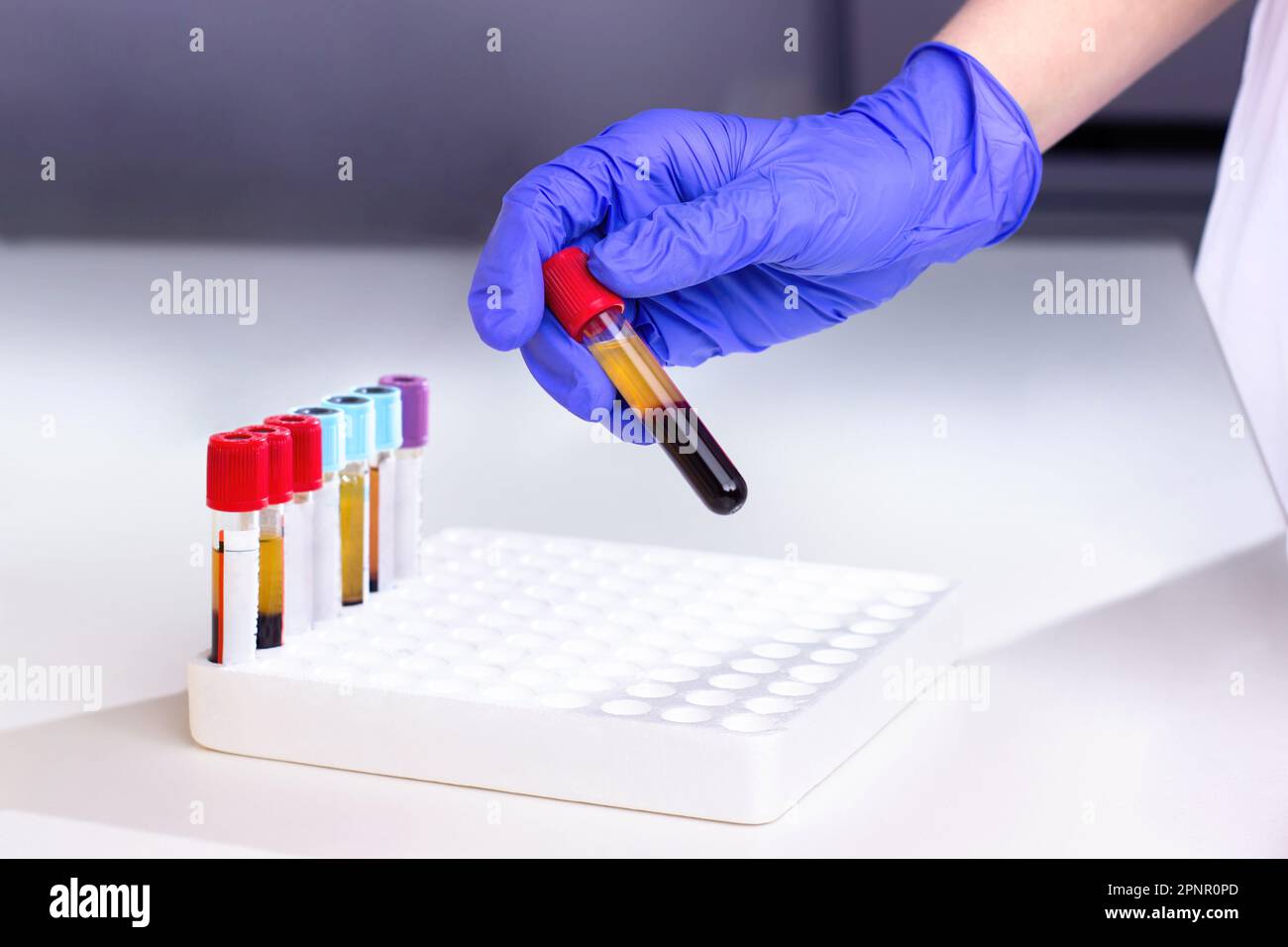 hands of a laboratory assistant with a blood sample and fortitude with ...