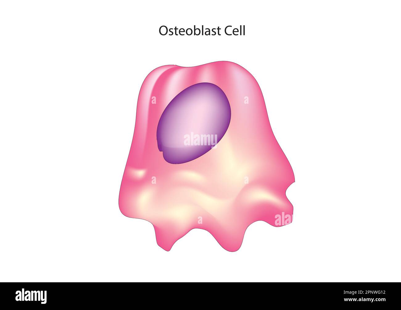Giant tumor Stock Vector Images - Alamy
