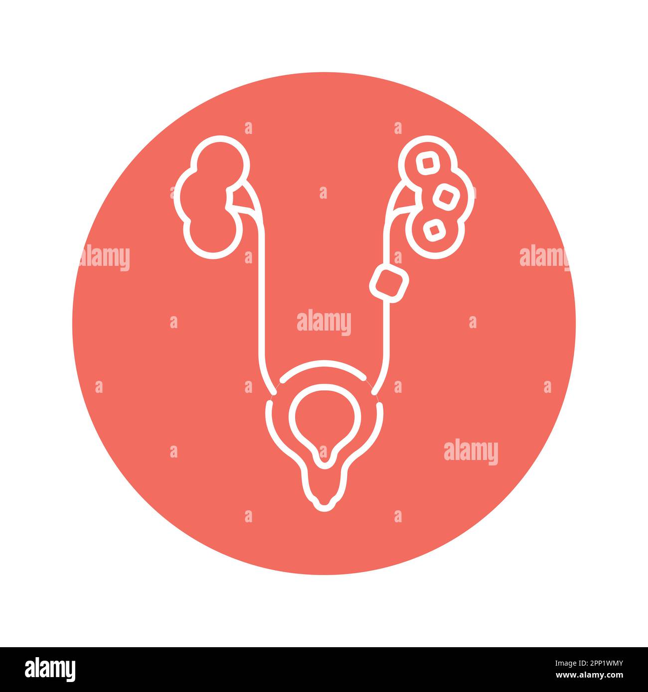 Urolithiasis disease Stock Vector Images - Alamy