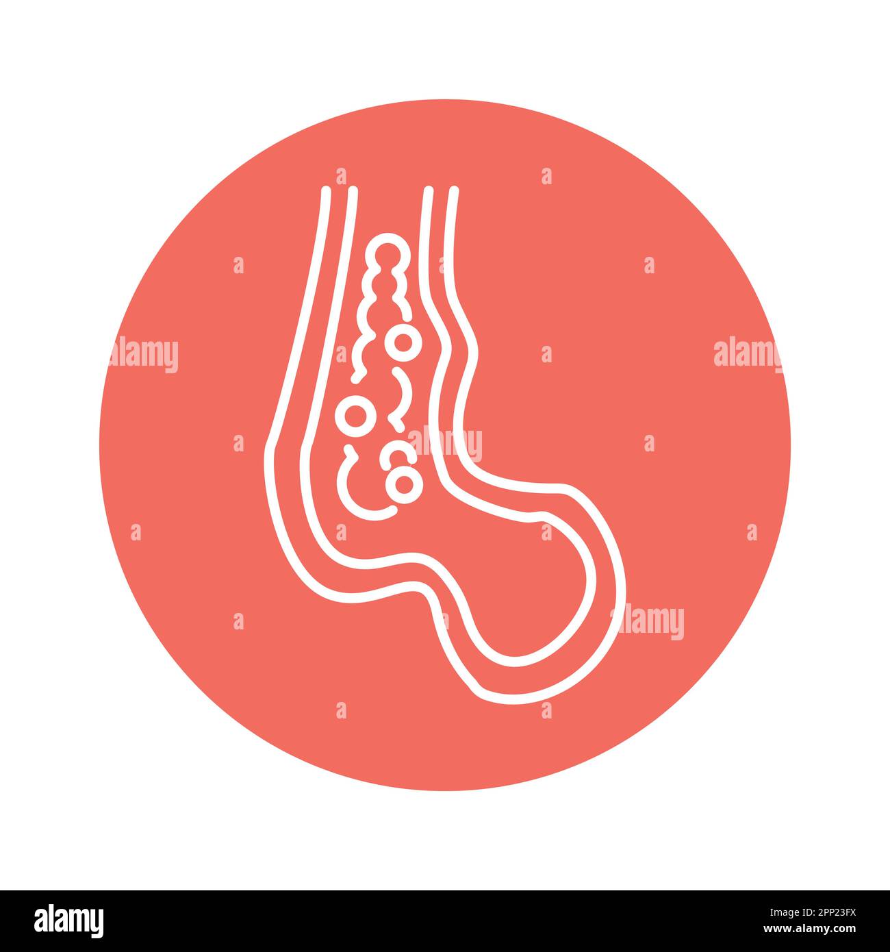 Myeloma disease Stock Vector Images - Alamy