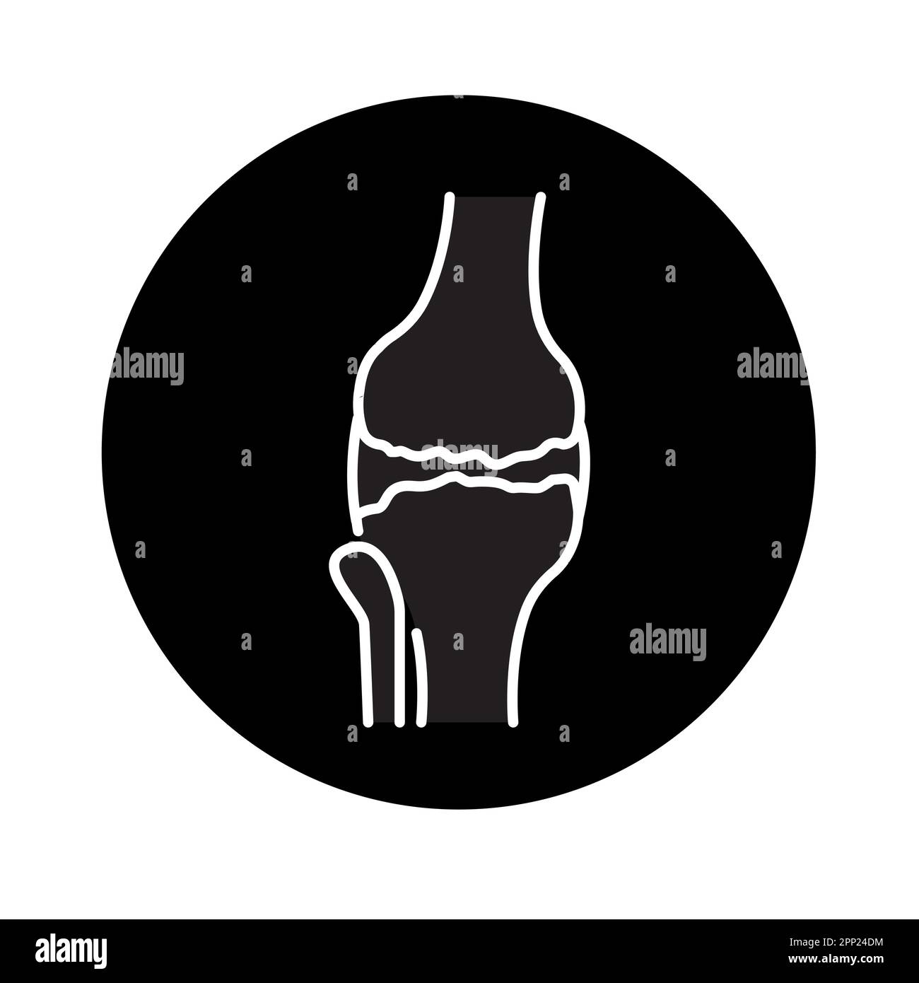 Rheumatoid arthritis drawing Black and White Stock Photos & Images - Alamy