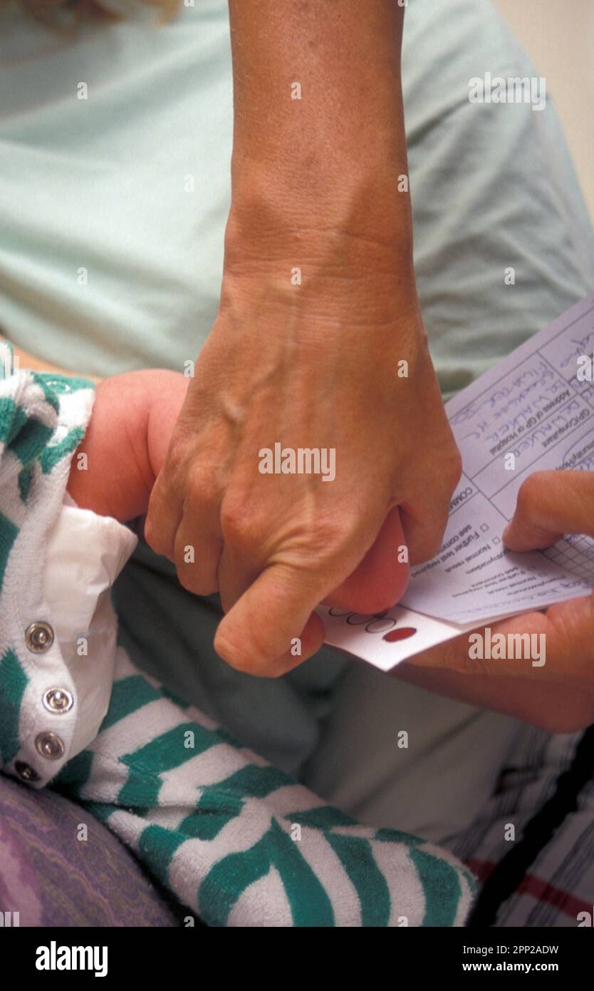 newborn baby having routine blood spot heel prick test Stock Photo - Alamy