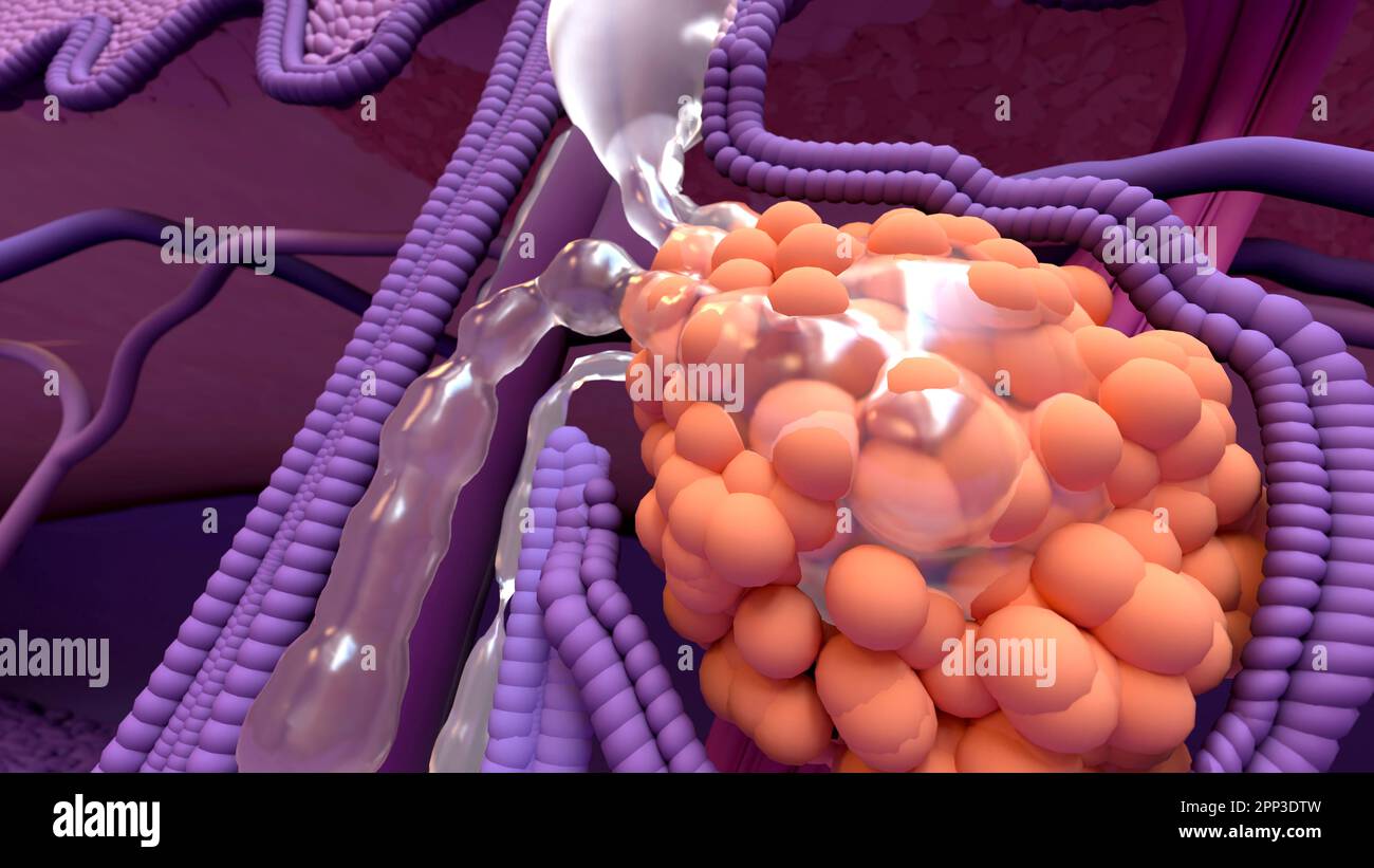 Sebaceous gland, illustration Stock Photo - Alamy