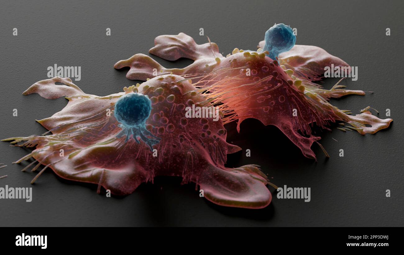 CAR-T cell therapy, illustration Stock Photo - Alamy
