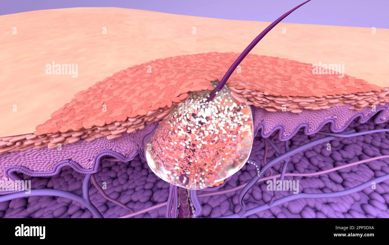 Pimple Under Microscope