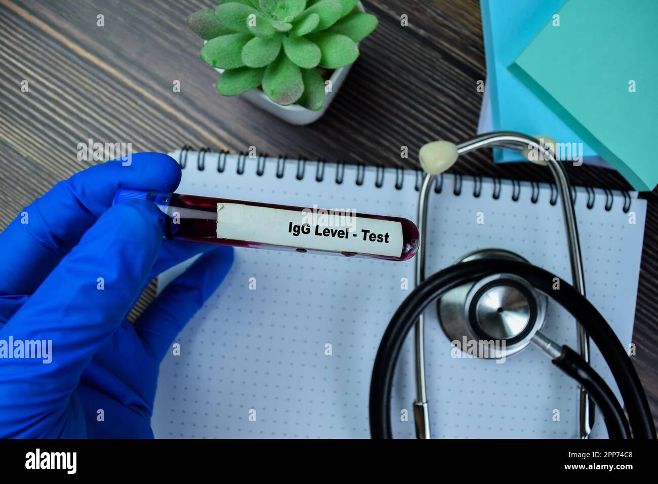 Concept of IgG Level - Test with blood sample Stock Photo - Alamy