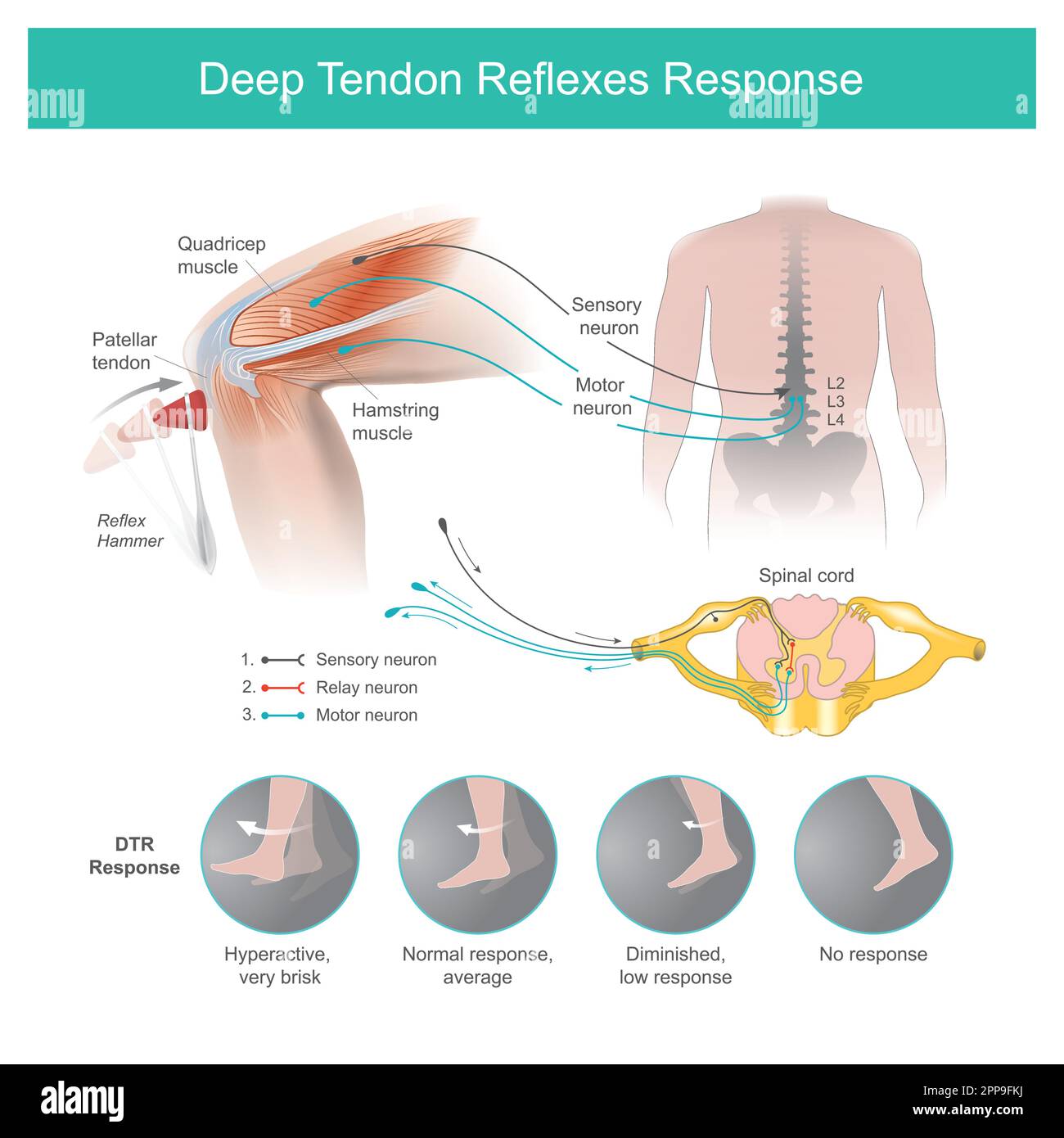 Deep tendon reflex Cut Out Stock Images & Pictures - Alamy