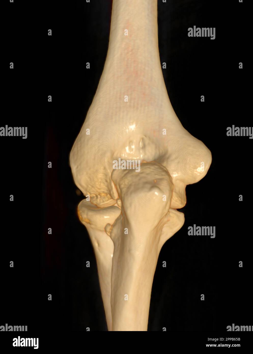 Elbow flexion hi-res stock photography and images - Alamy