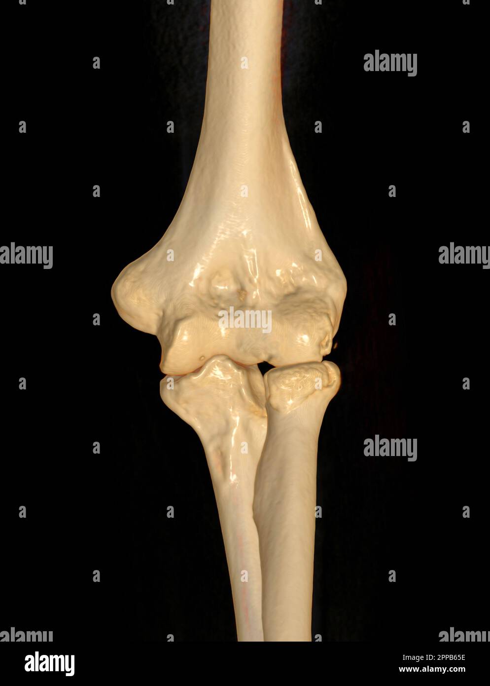 CT scan of elbow joint 3d rendering Stock Photo - Alamy
