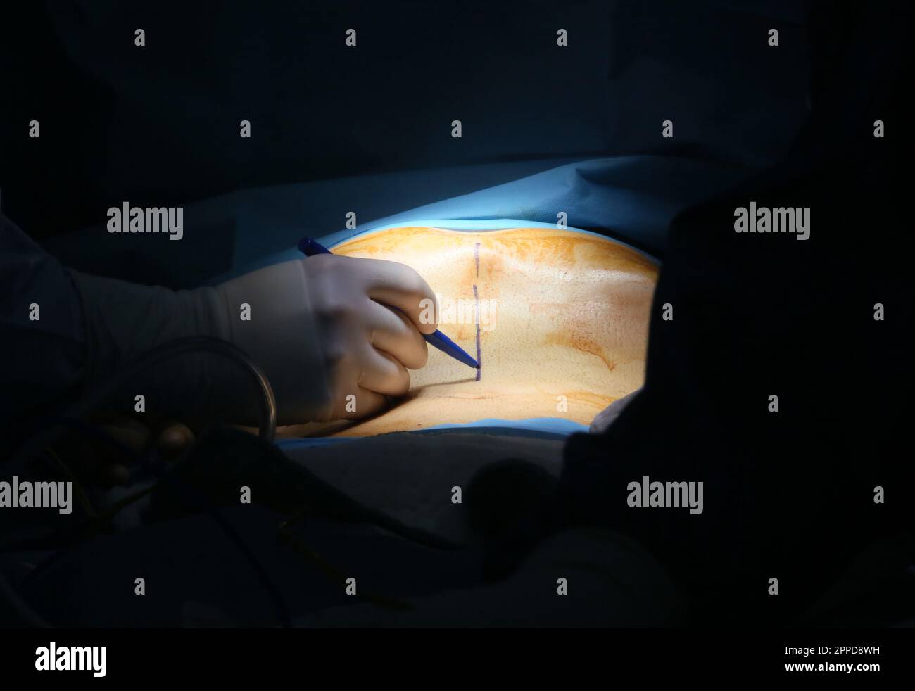 Operation wallpaper hi-res stock photography and images - Alamy