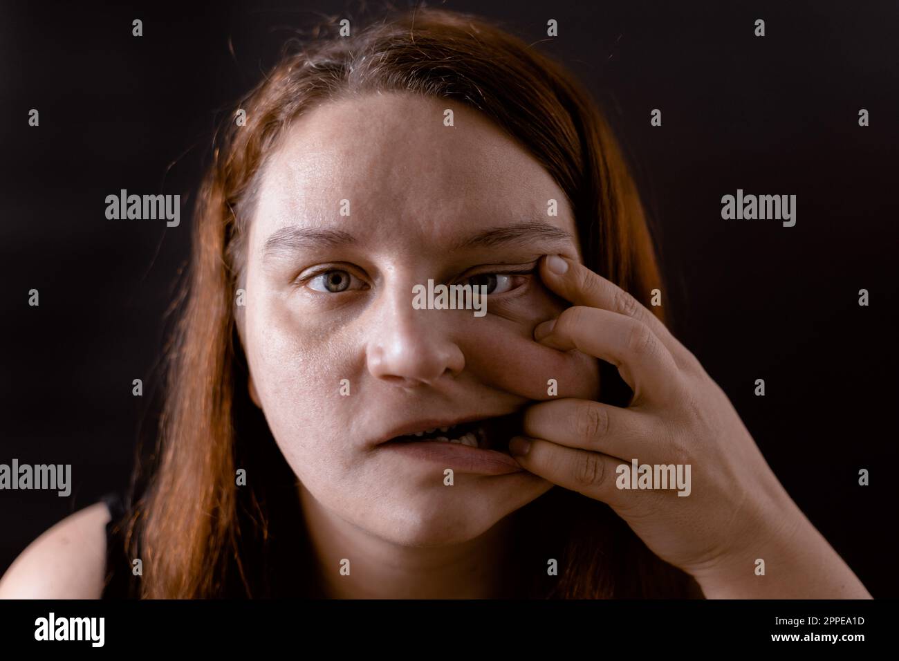 Freaky ill woman pulling skin of face to side by fingers. Pain ...