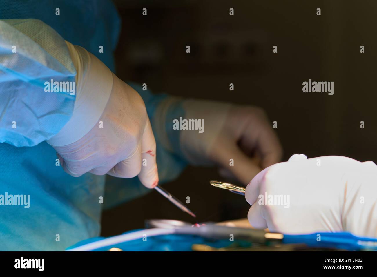 Laparoscopic operation hi-res stock photography and images - Alamy
