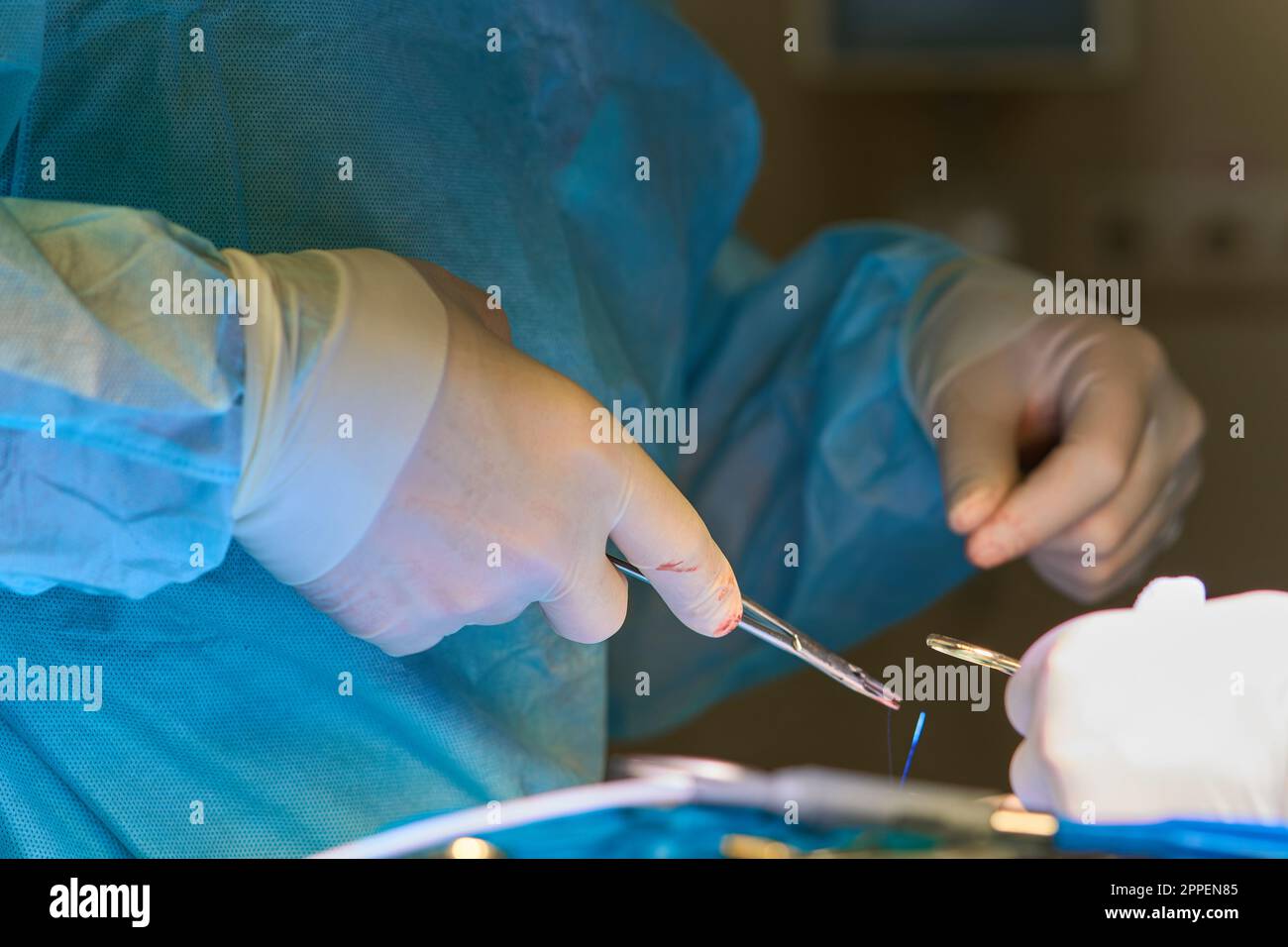 Laparoscopic operation hi-res stock photography and images - Alamy