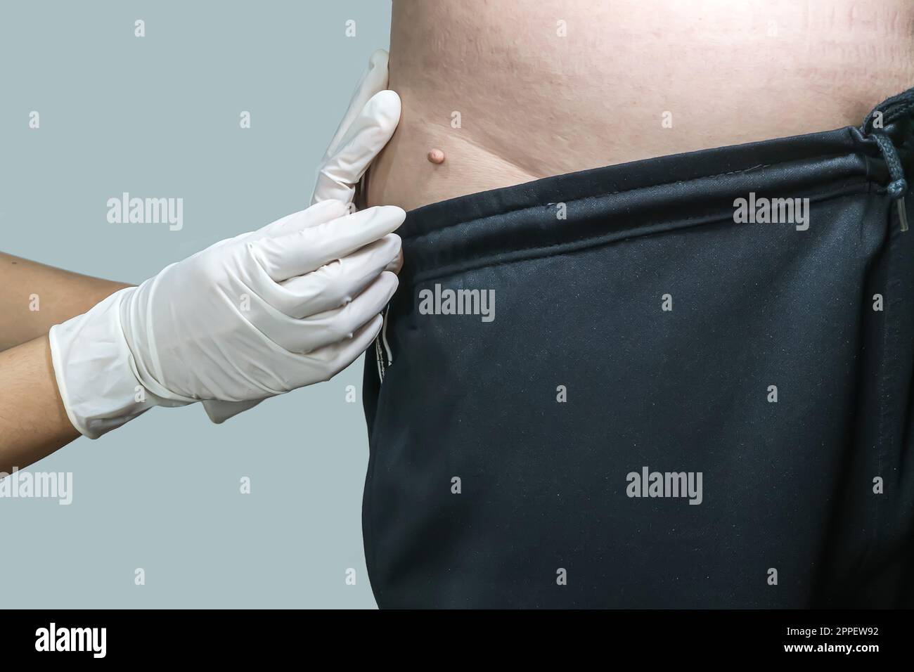 Skin tag or acrochondon or soft fibroma is a safe. It have not effect ...