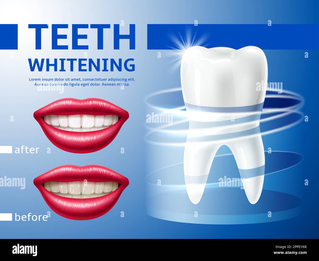 Whitening Teeth Ads