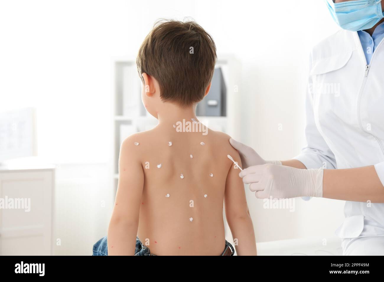 Doctor applying cream onto skin of little boy with chickenpox in clinic ...