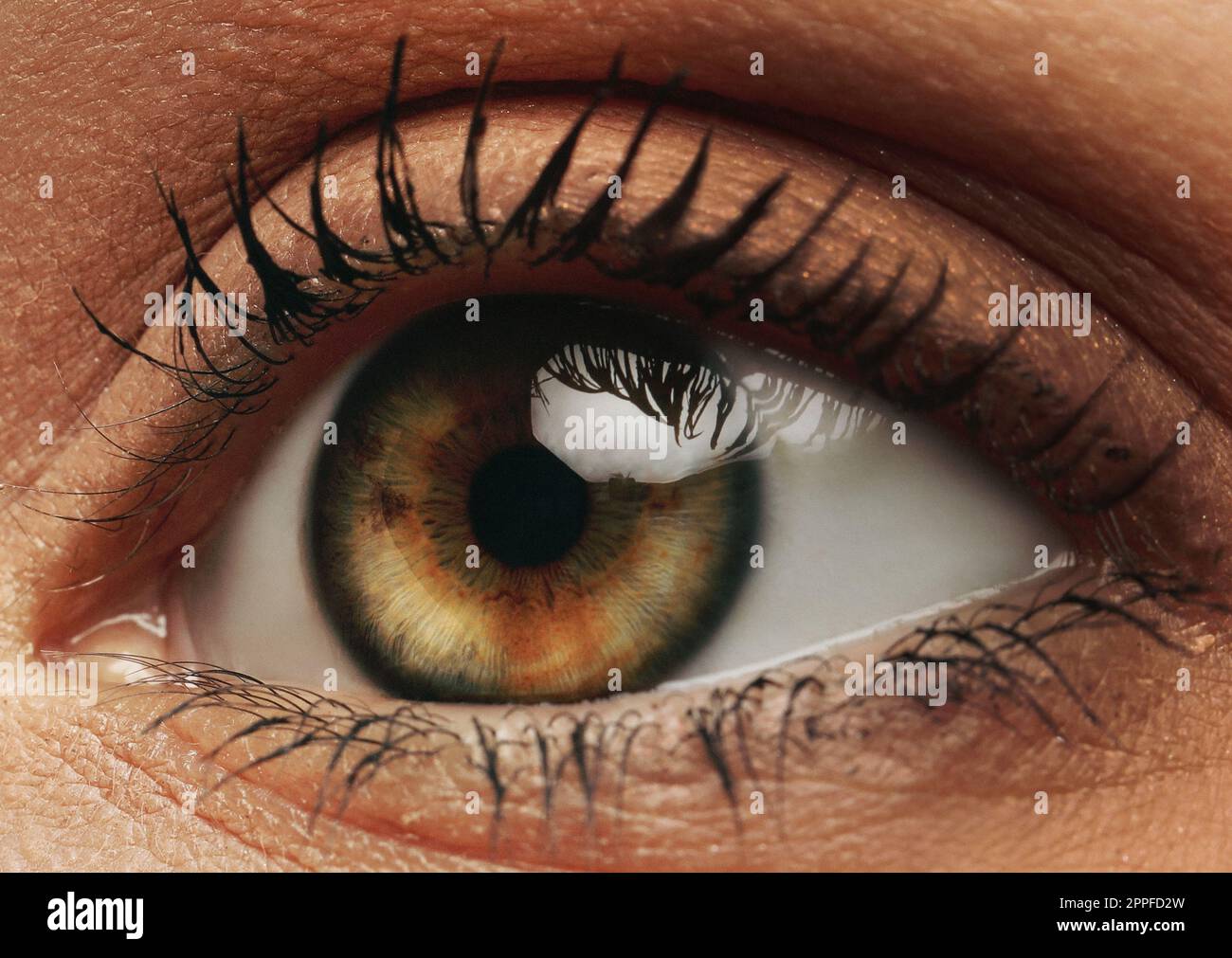 Cataract female eye closeup ophthalmology hi-res stock photography and ...
