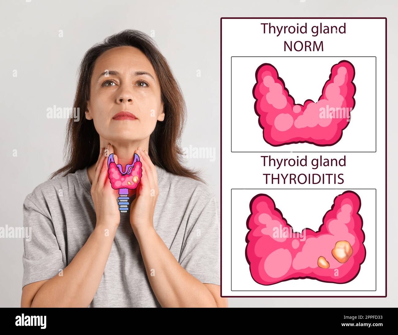 Woman and illustration of thyroid gland on white background Stock Photo ...