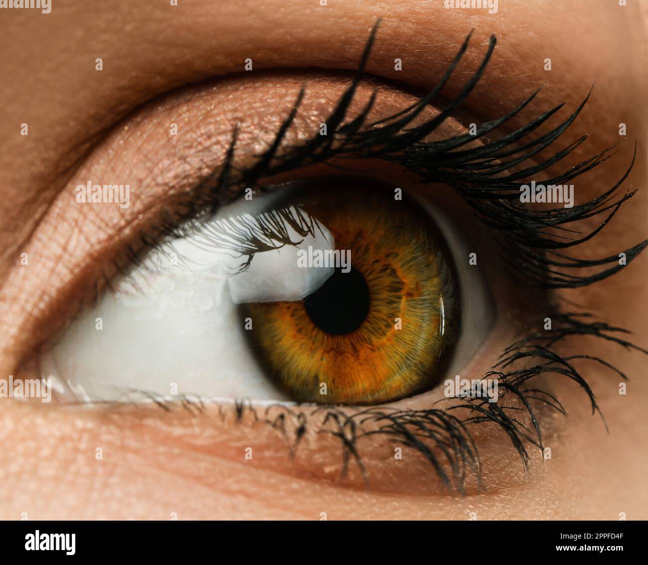Cataract female eye closeup ophthalmology hi-res stock photography and ...