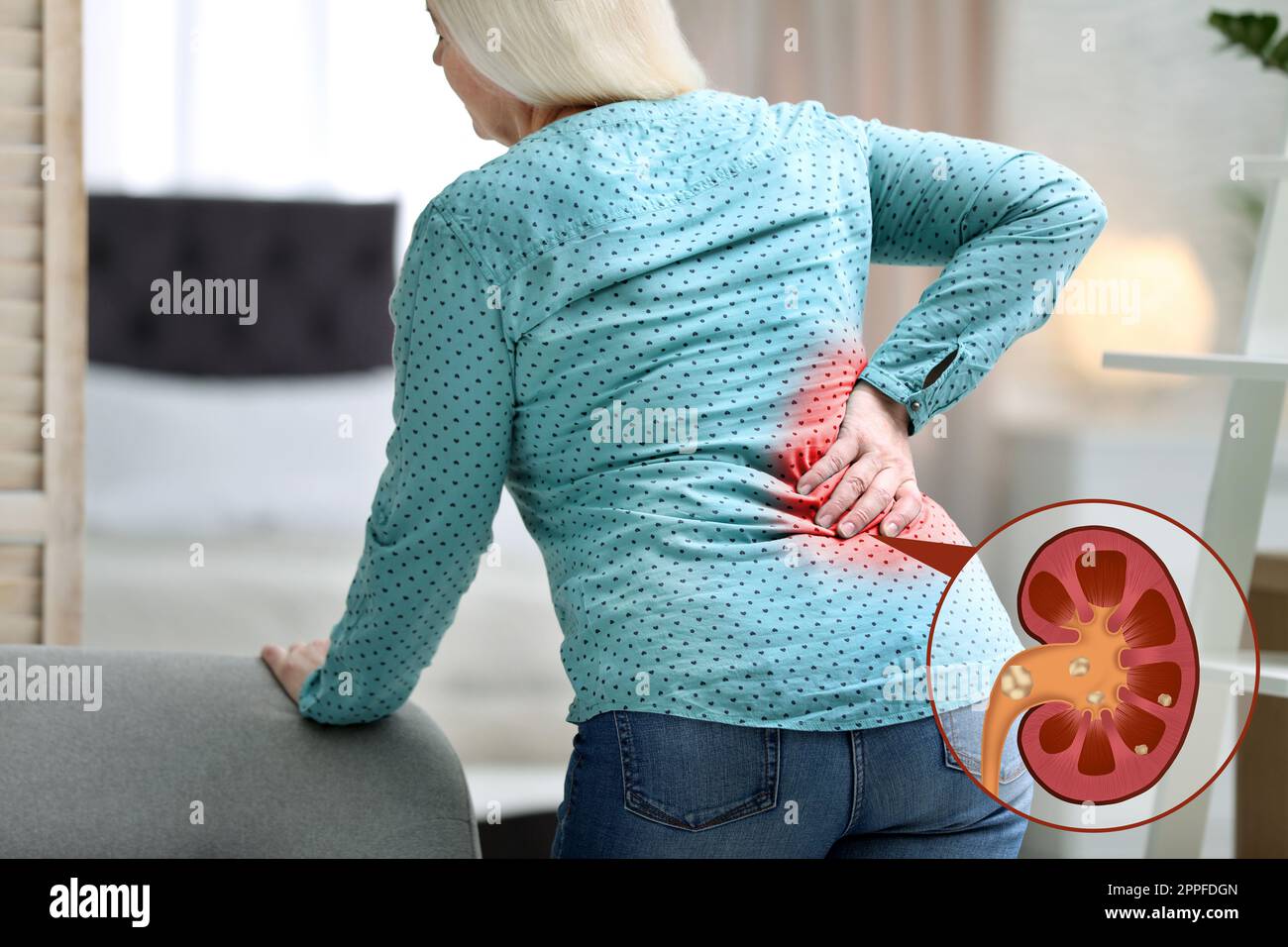 Mature woman suffering from pain because of kidney stones disease at ...