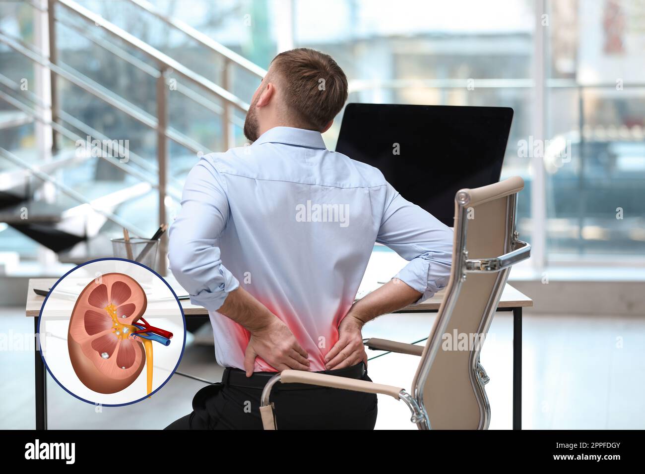 Man suffering from pain because of kidney stones disease in office ...