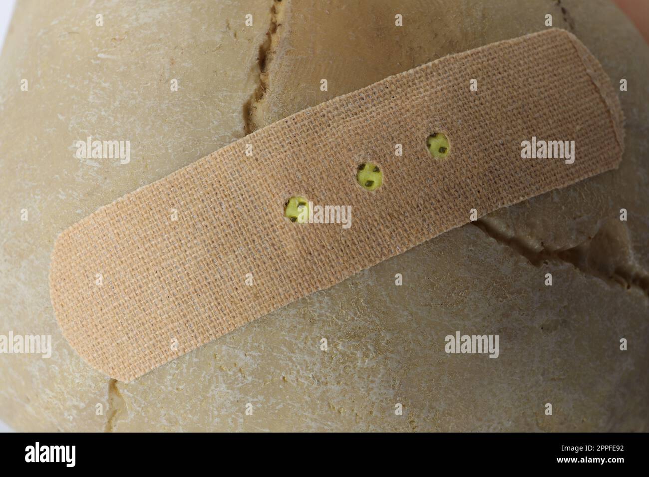 Human head skull broken hi-res stock photography and images - Alamy