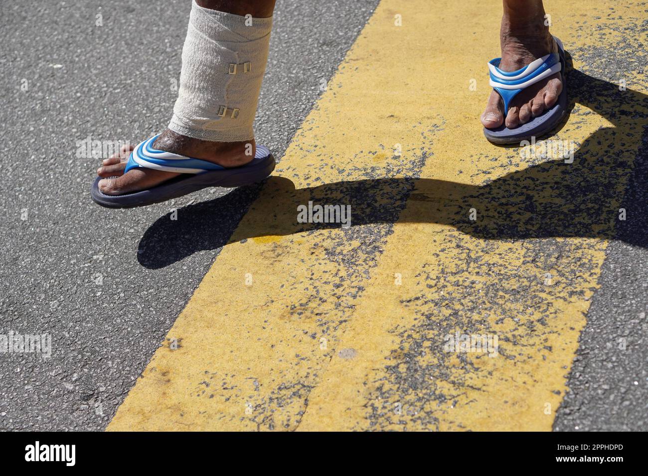 Select focus the wound foot walk at street Stock Photo - Alamy