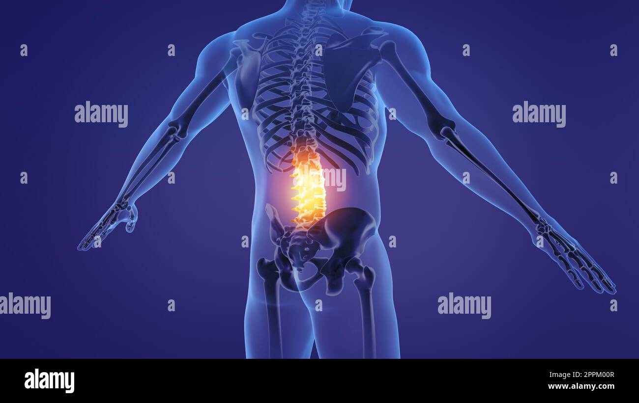 Animation of a painful lumbar spine Stock Photo - Alamy