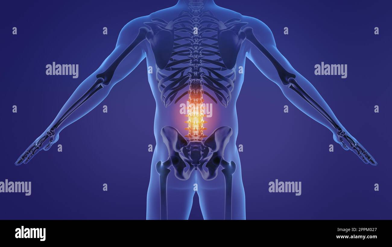 Animation of a painful lumbar spine Stock Photo - Alamy