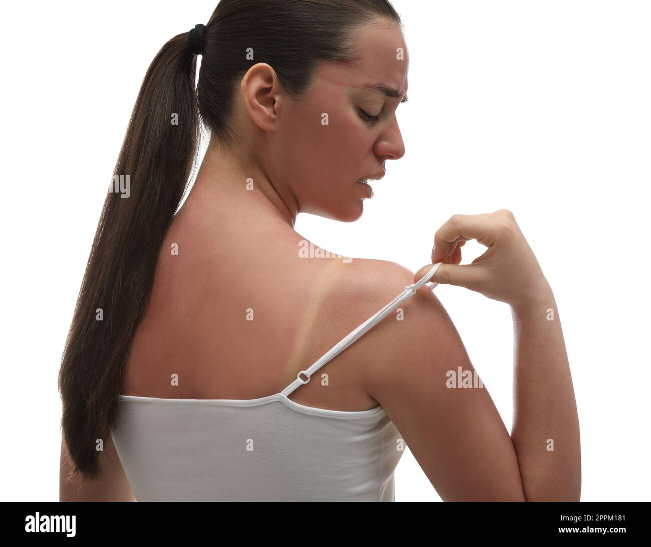 Woman sore skin beach hi-res stock photography and images - Alamy