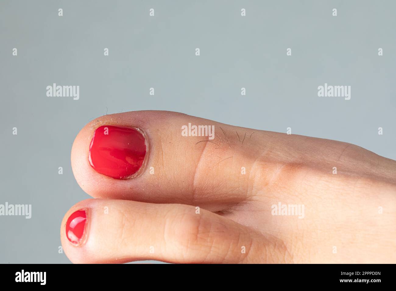 Woman hairy toes hi-res stock photography and images - Alamy