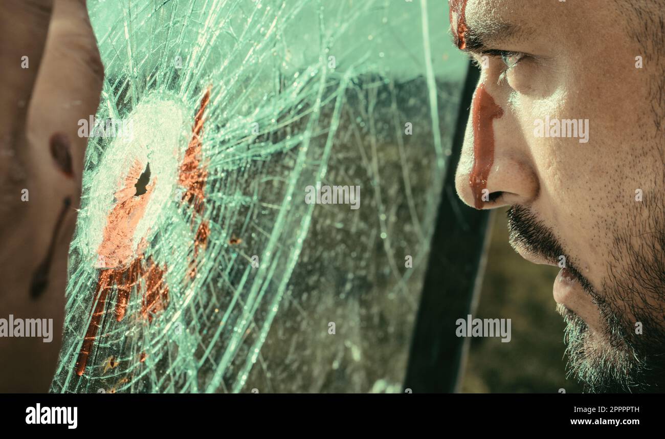 Surviving an injury. Latino man with wound injury looking through ...