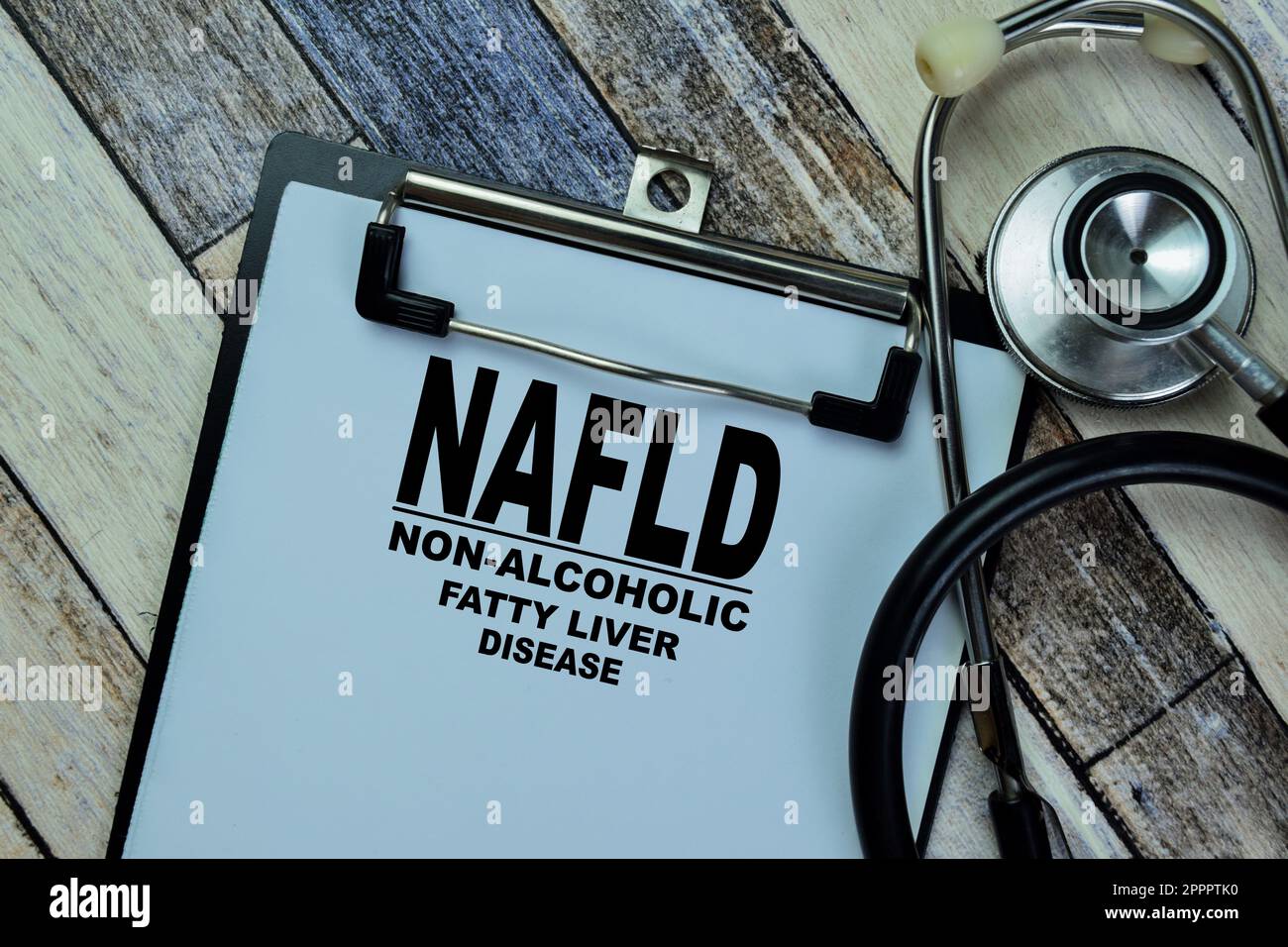 Concept of NAFLD - Non-Alcoholic Fatty Liver Disease write on paperwork ...
