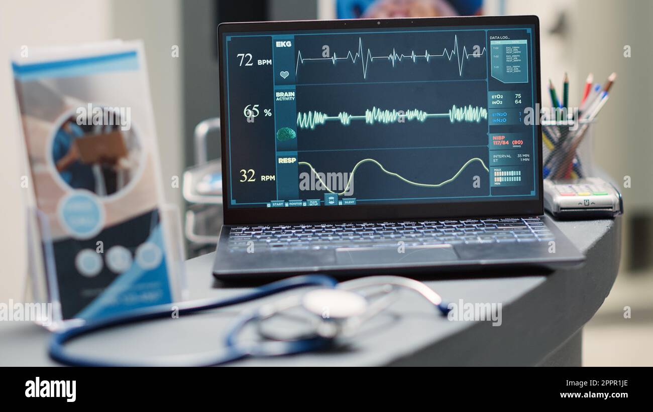 Heart rate monitor on laptop at counter, showing electrocardiogram for ...