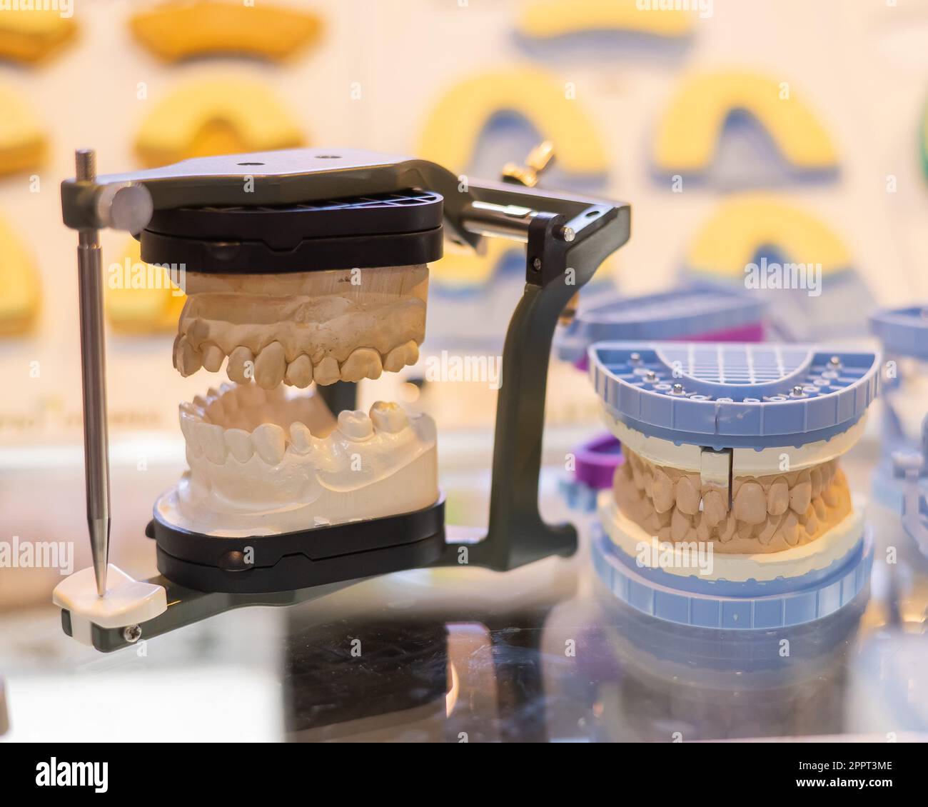 Plaster cast of the jaw in the articulator in the prosthetic workshop ...
