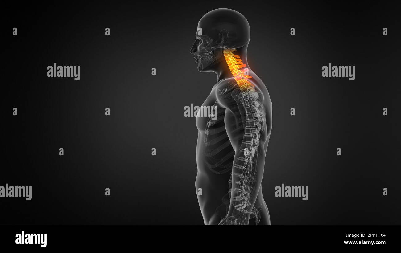 Neck injury video hi-res stock photography and images - Alamy