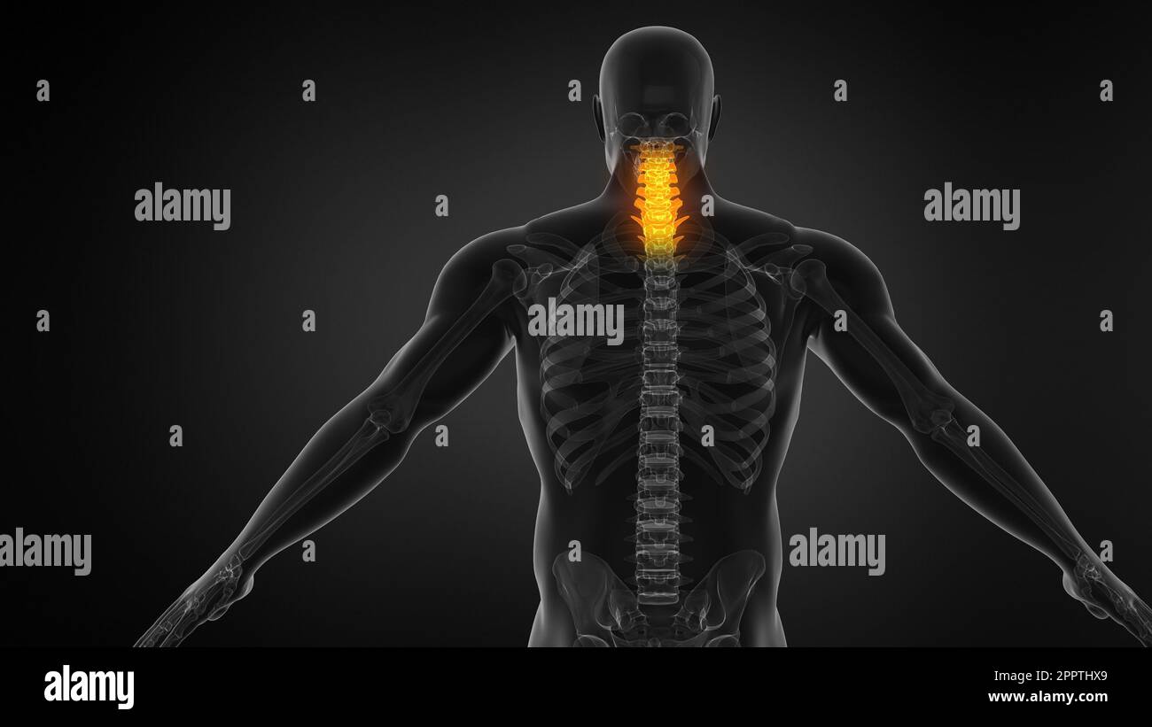 Anatomy of Human Spine. Neck pain Stock Photo - Alamy