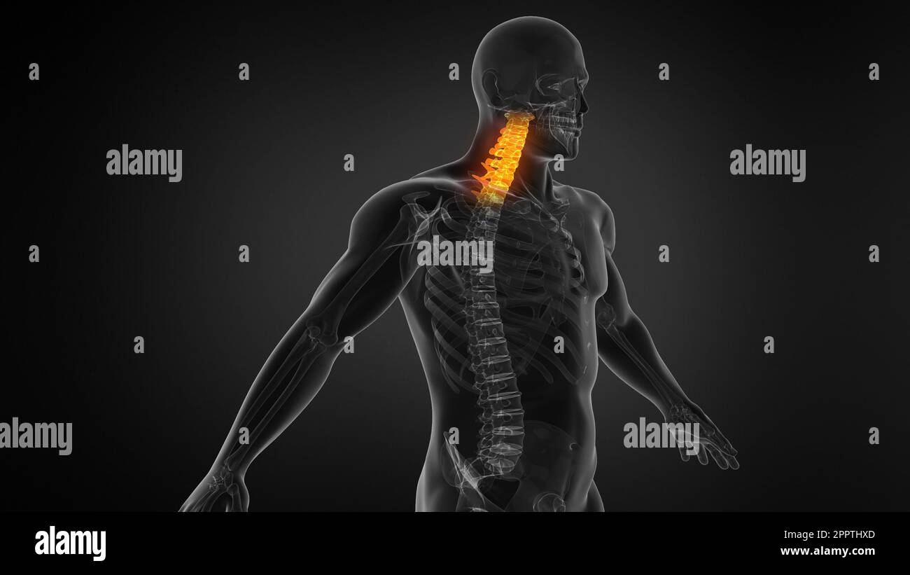 Anatomy of Human Spine. Neck pain Stock Photo - Alamy