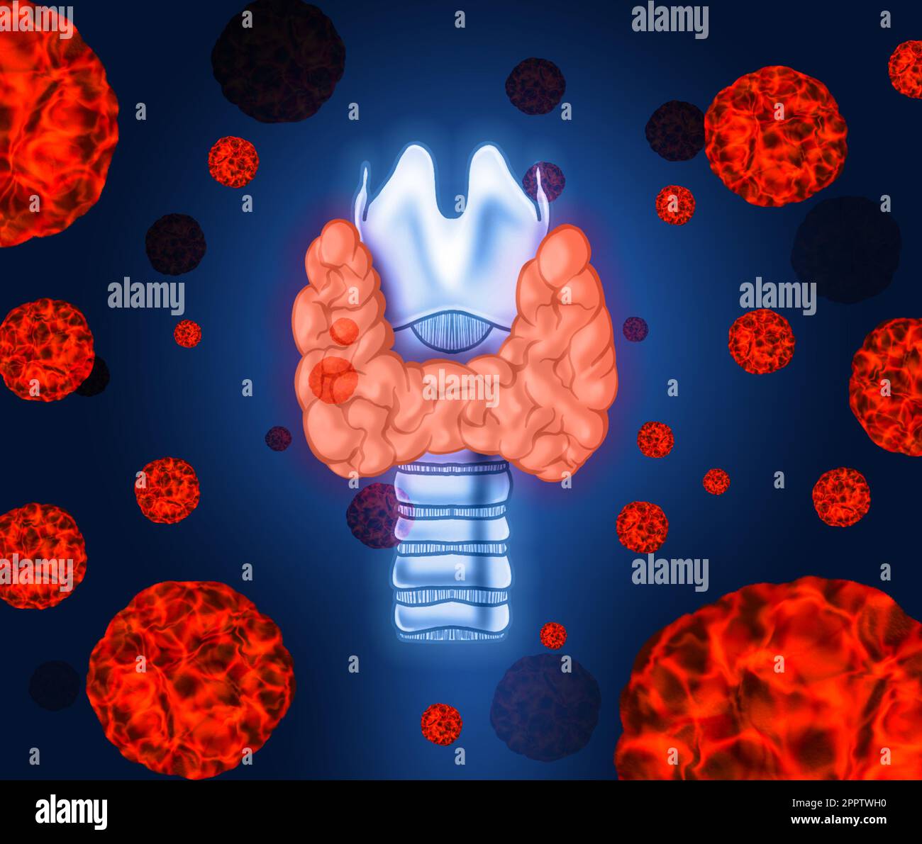 Illustration of human thyroid cancer on blue background Stock Photo - Alamy