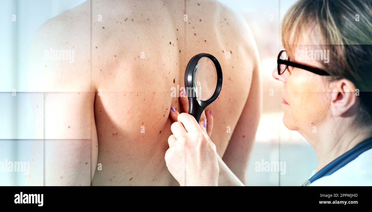 Dermatologist examining the skin on the back of a patient, geometric ...