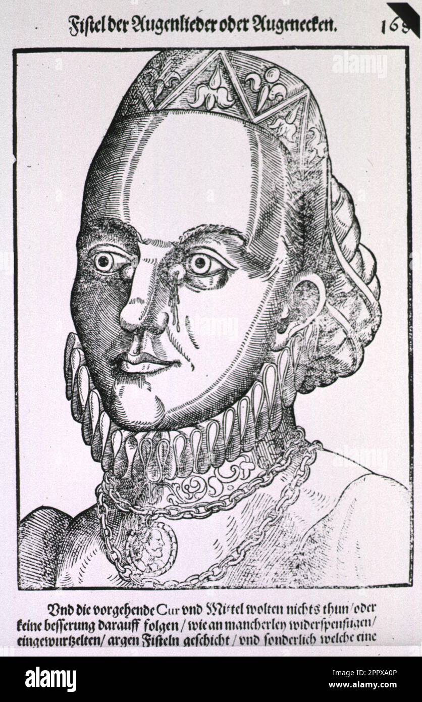 Ophthalmology ancient hi-res stock photography and images - Alamy