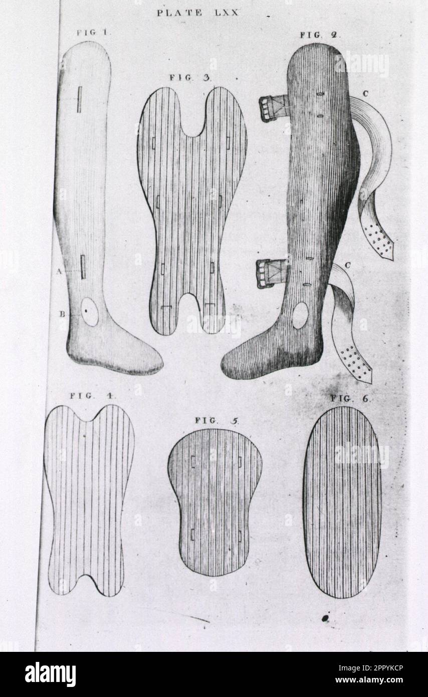 Orthopedic splints hi-res stock photography and images - Alamy