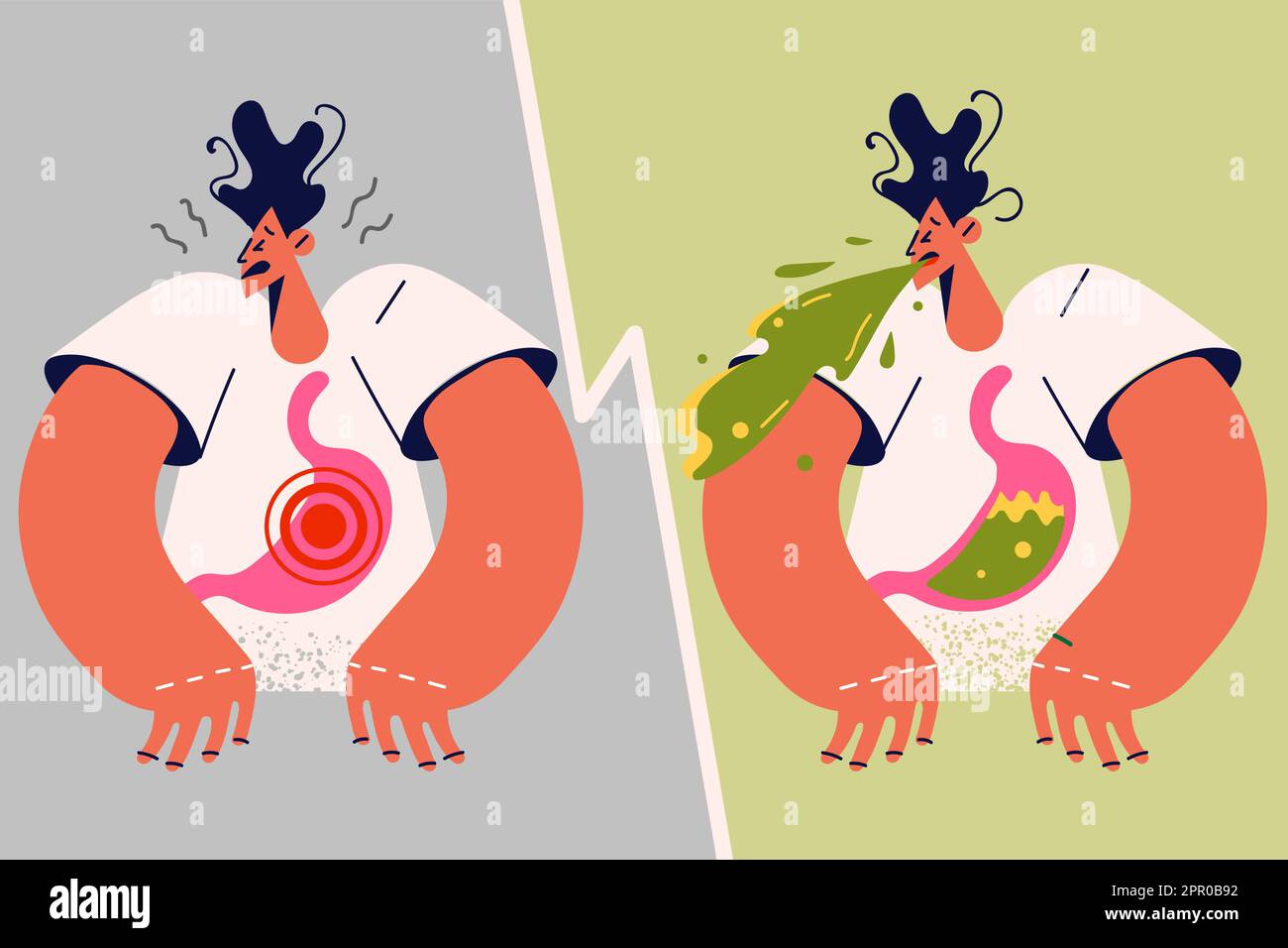 Unhealthy man suffer from indigestion and vomiting Stock Vector Image ...