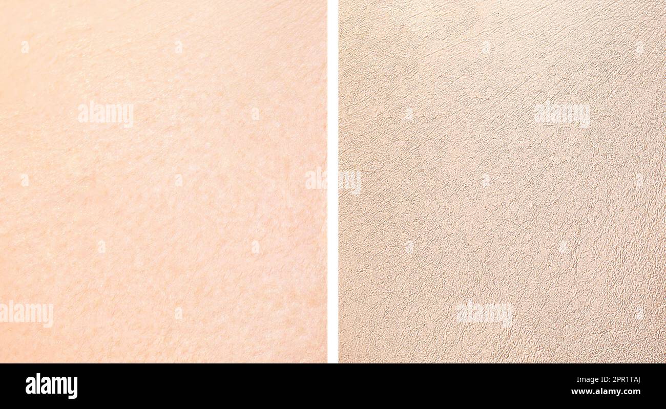 Collage with photos of dry and moisturized skin texture Stock Photo - Alamy