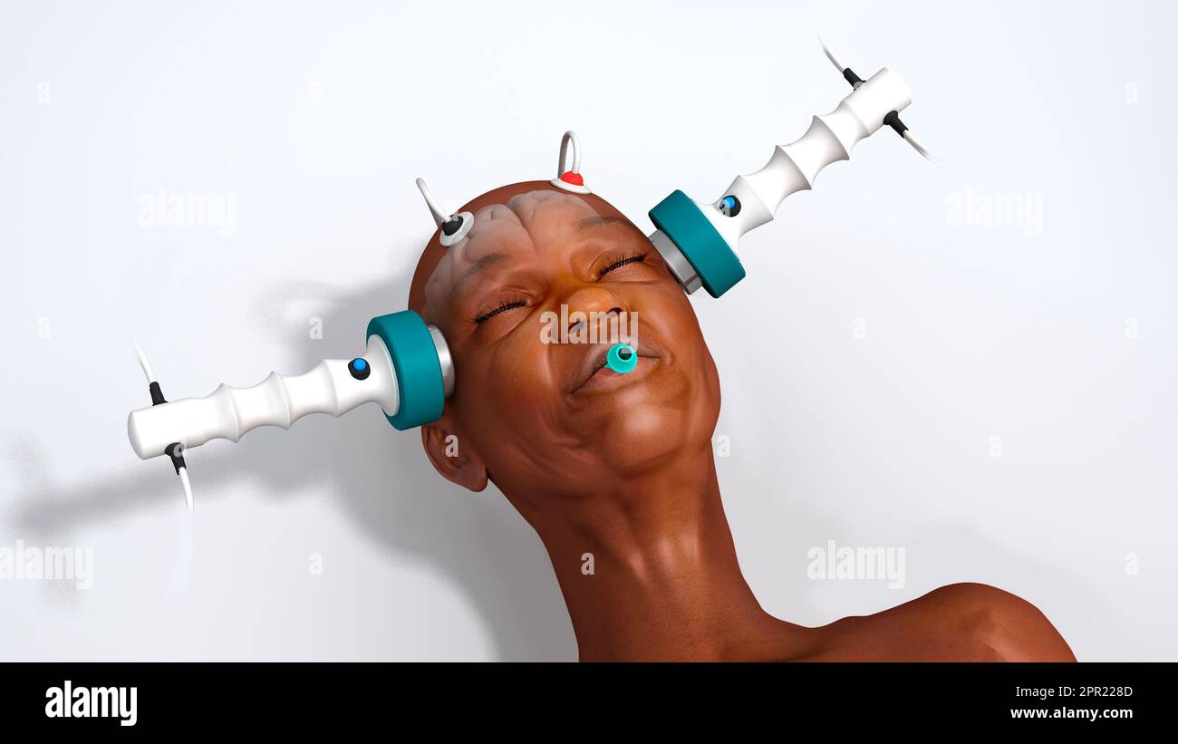 Electroconvulsive therapy, illustration Stock Photo - Alamy