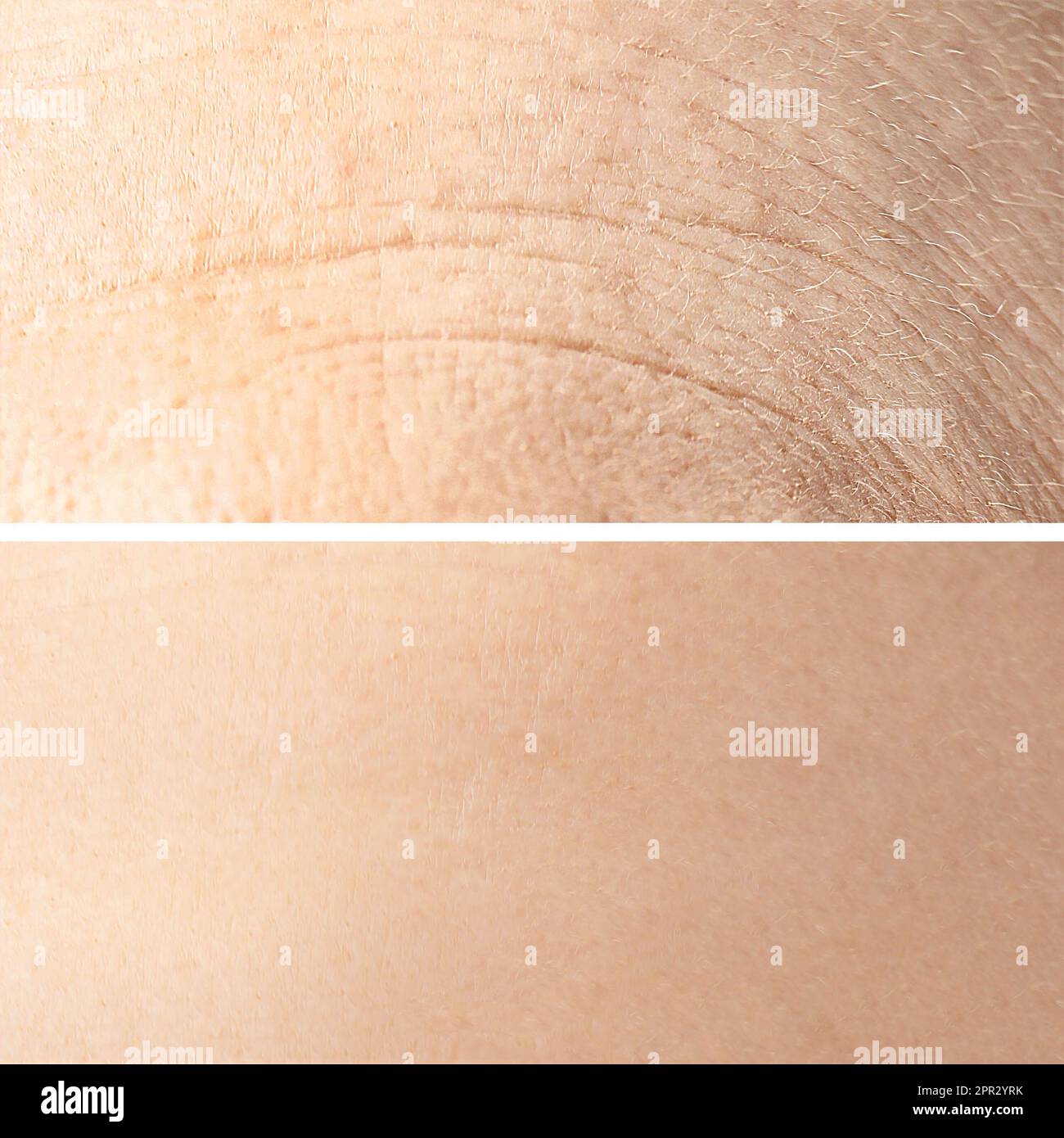 Collage with photos of dry and moisturized skin texture Stock Photo - Alamy