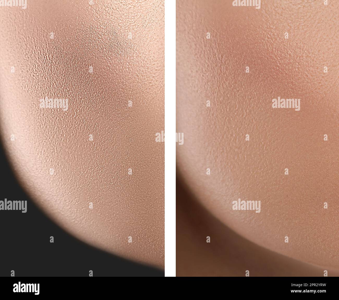 Collage with photos of dry and moisturized skin texture Stock Photo - Alamy