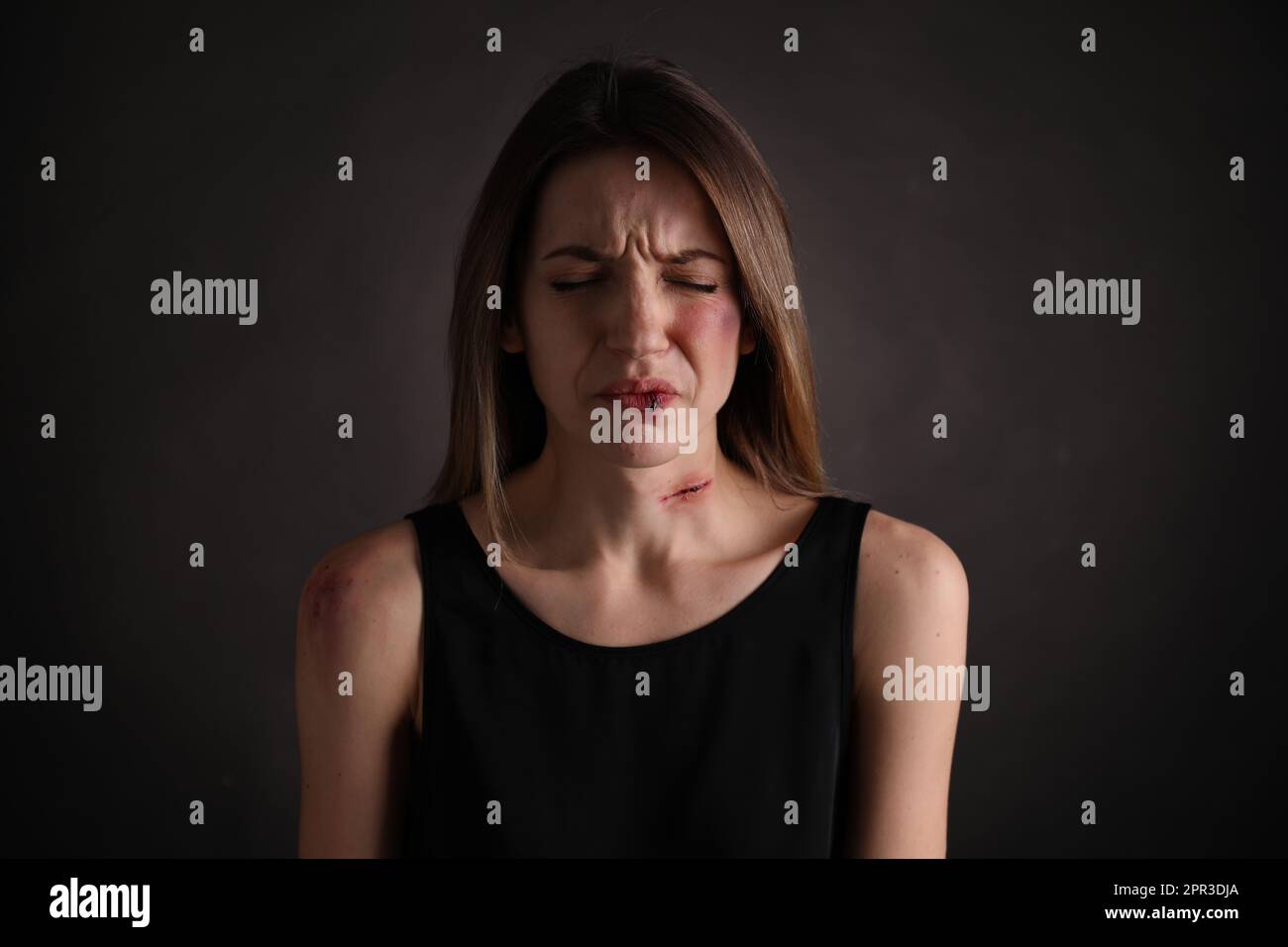 Woman with facial injuries on black background. Domestic violence ...